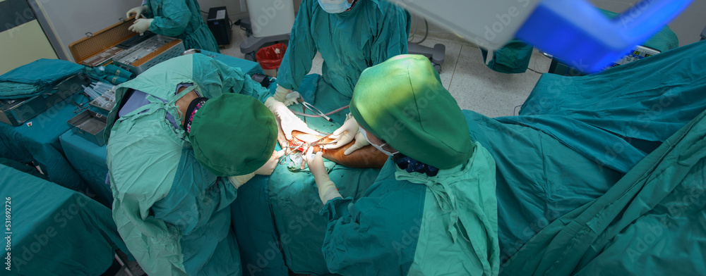 Top view, Team orthopedic surgeons performing leg surgery patient ...