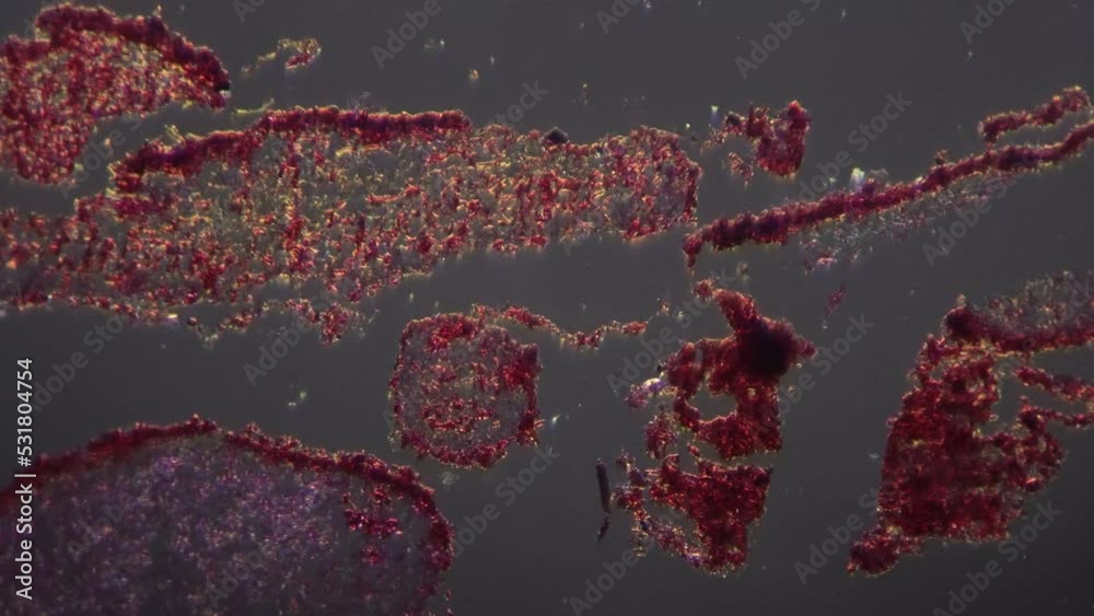 Microscopic image of the lichen sec. magnified in 400 times and filmed ...