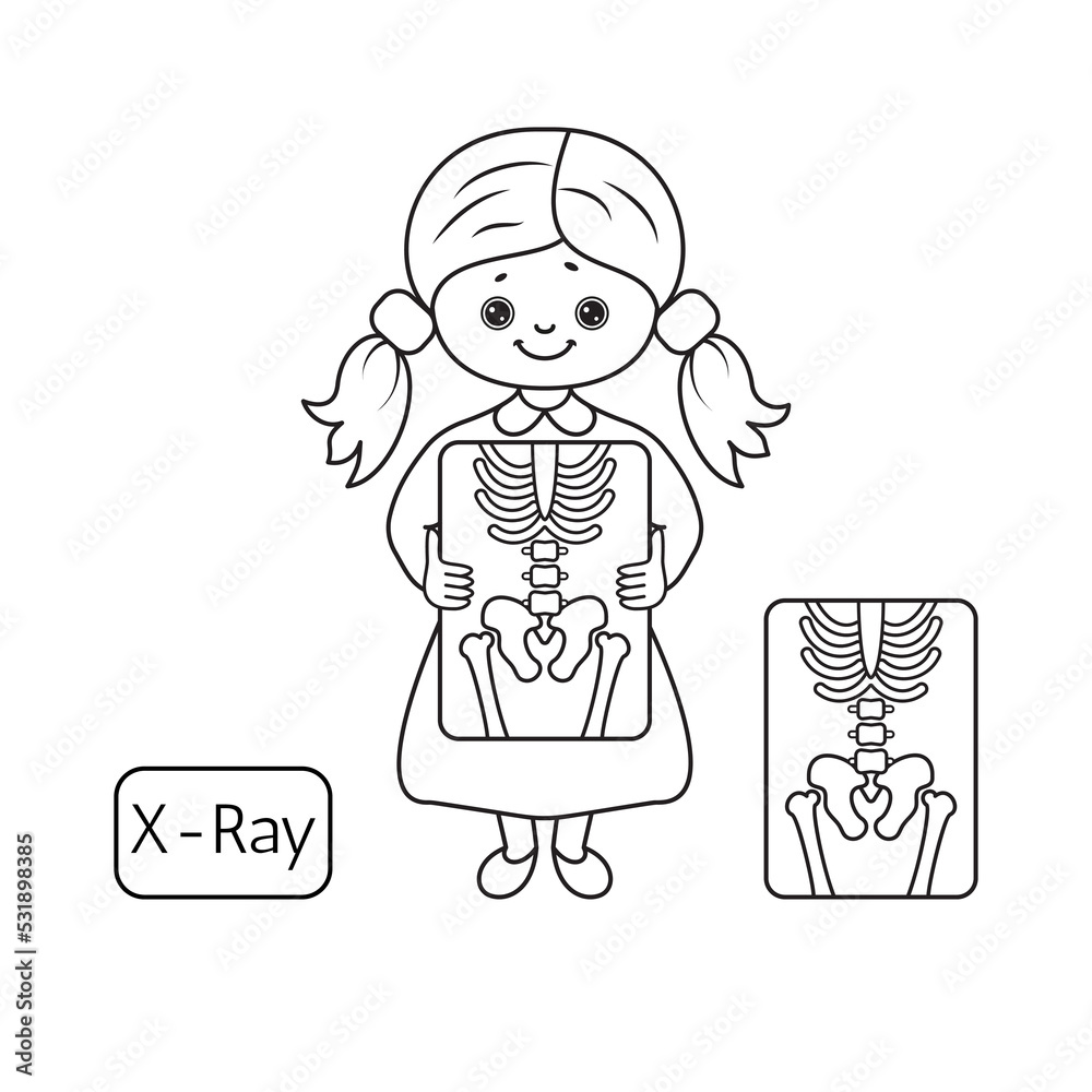 X-Ray Girl. Vector Illustration. Stock Vector | Adobe Stock