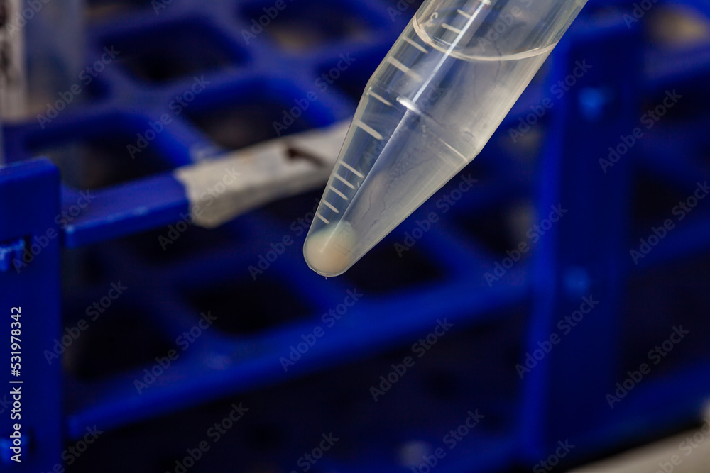 Test tube with blood cells pellet obtained after several washes and ...
