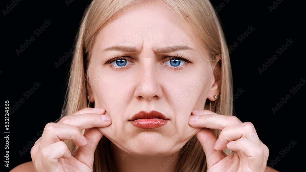 Second chin, obesity. Portrait of a 30-year-old woman pulling back the ...