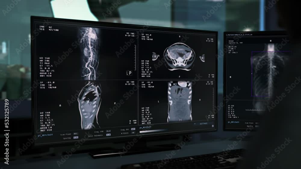 Multiple Diagnostic Anatomical Examination Screens Inspecting Internal ...