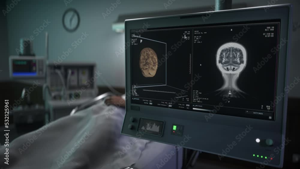 Medical scanner examines the patients skull at the hospital. Medical ...