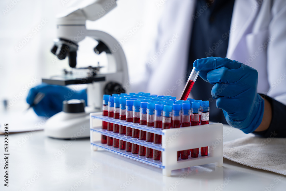 Doctor hand taking a blood sample tube from a rack with machines of ...