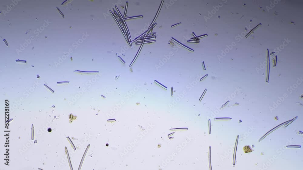 Spincule of Spongia whole mount under microscope 100x on white ...