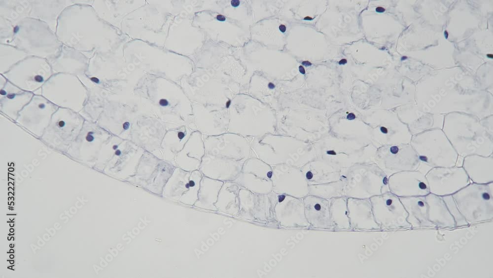 Ovary of Lilium in transversal section under microscope 200x against ...