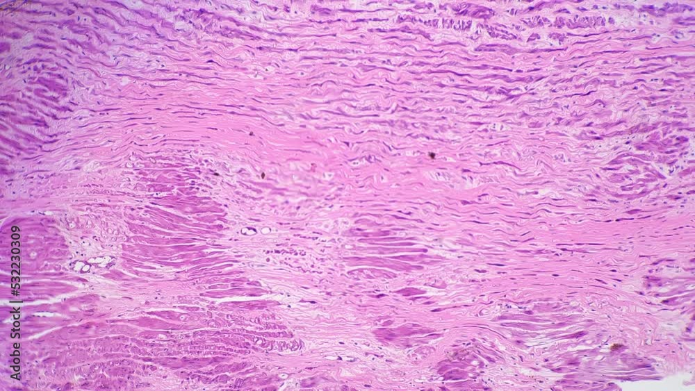 Simple squamous epithelium sec. filmed under microscope with 100 times ...