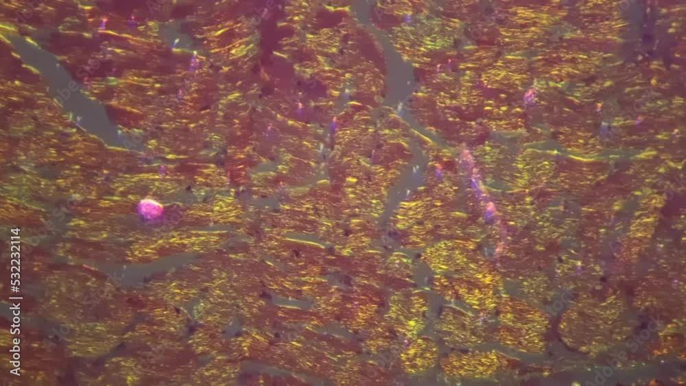 Macro sample of stratified squamous epithelium sec. magnified in 400 ...