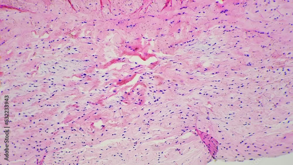 Dense connective tissue in longitudinal section under microscope 100x ...