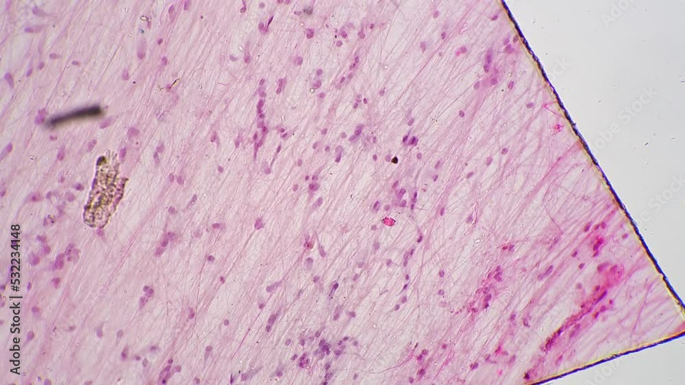 Loose connective tissue whole mount microscopic view with 100 times ...
