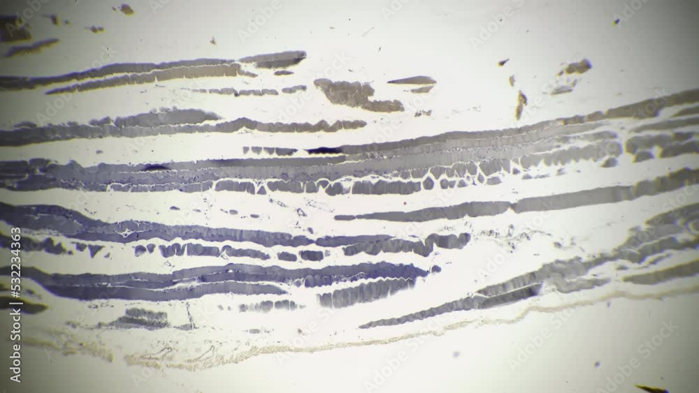 Skeletal muscle in longitudinal section under microscope filmed with 40 ...