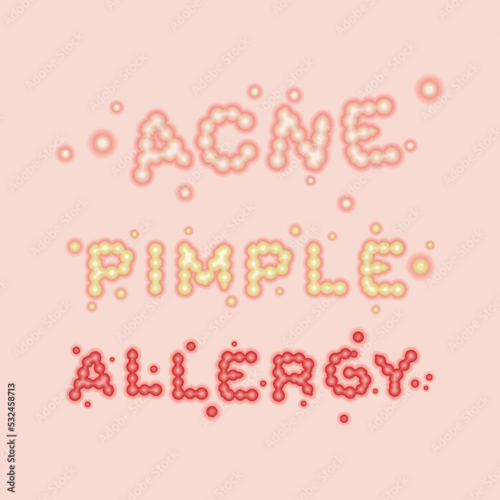 Acne, Allergy and Pimple lettering set. Pimple lettersTypography. whelk ...