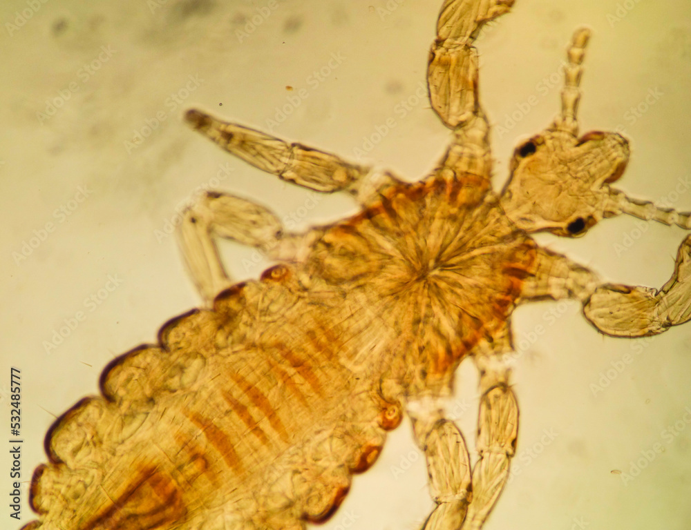 Human louse, Pediculus humanus, slide plate under high magnification in ...
