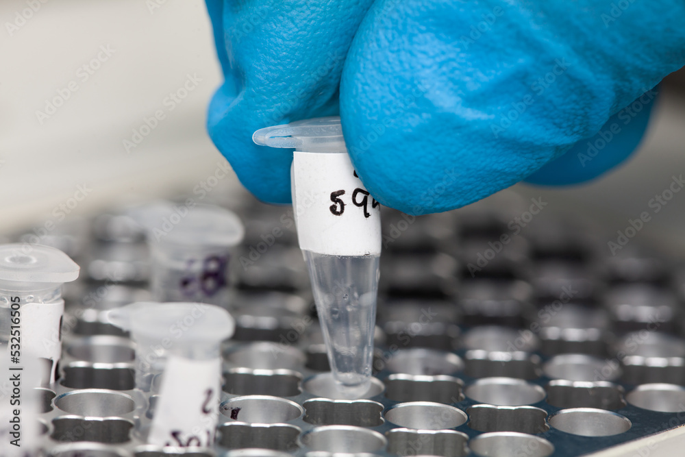 Closeup of a scientist hand while working at the laboratory with a ...