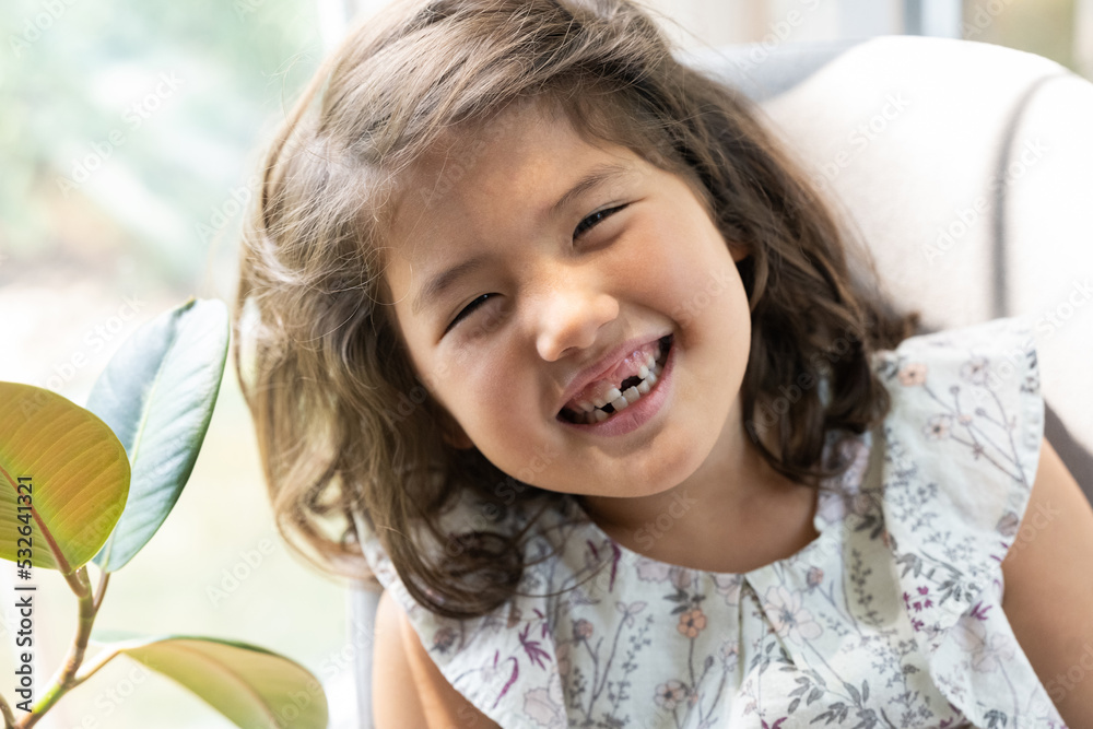 Happy child with big smile and missing teeth Stock Photo | Adobe Stock
