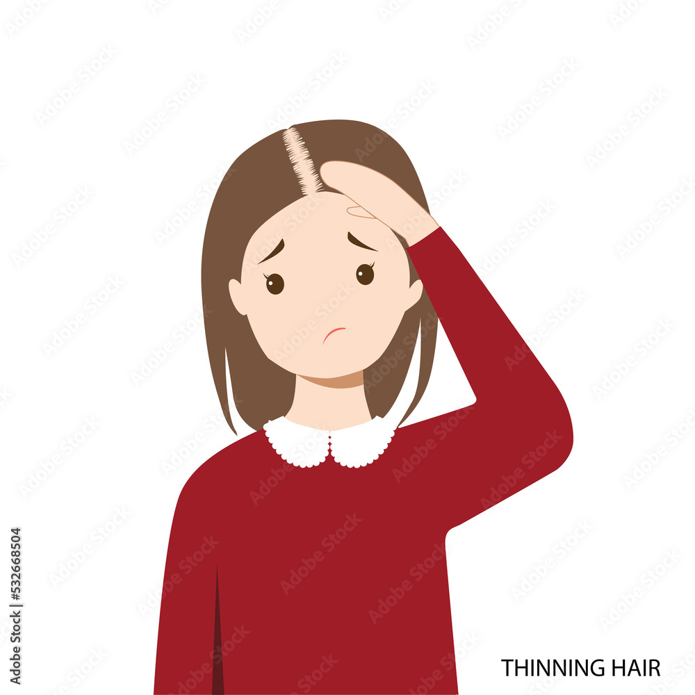 Young women worry about thinning hair balding, illustration cartoon ...
