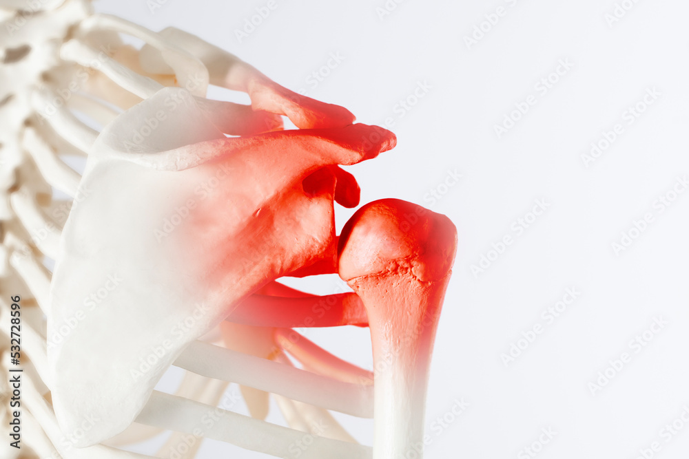 Shoulder blade pain, human skeleton body anatomy scapula and humerus ...
