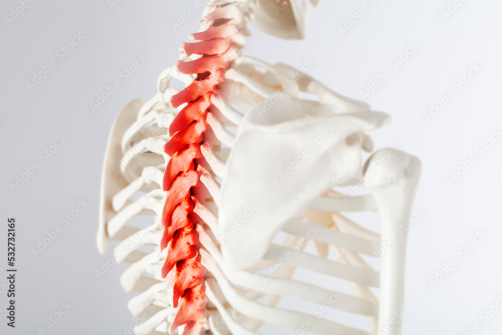 Back pain, backache, cervical vertebrae spine, human body anatomy Stock ...