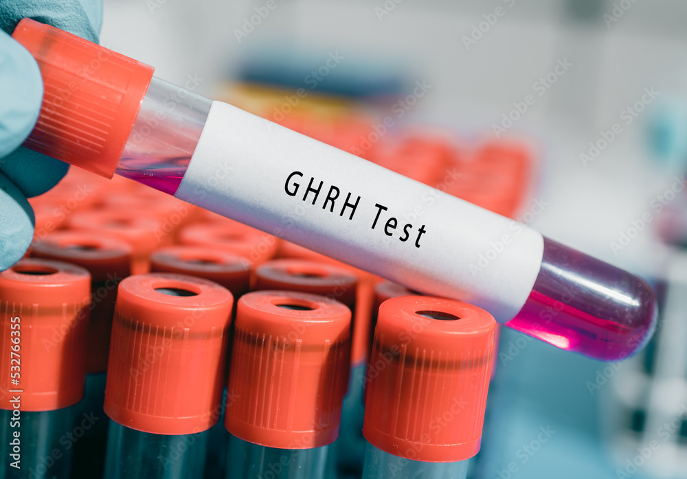 Hypothalamus Growth hormone releasing hormone GHRH Test Regulates ...