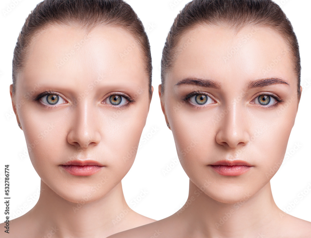 No Eyebrows Before And After