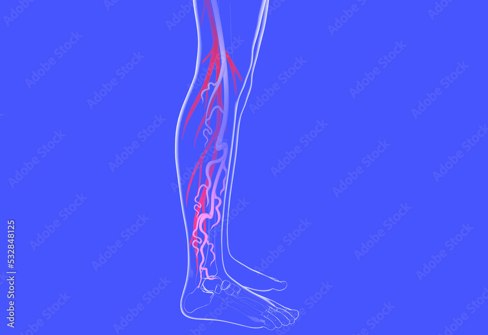 3d illustration of the venous system with varices. Transparent anatomy ...