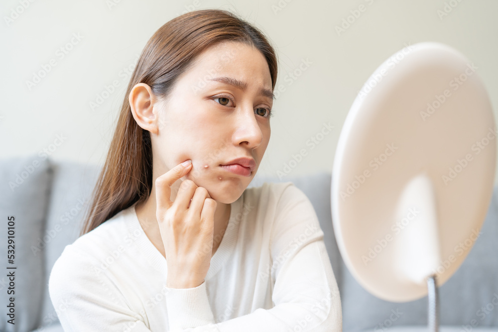 Expression worry asian young woman hand touching pustule around the ...