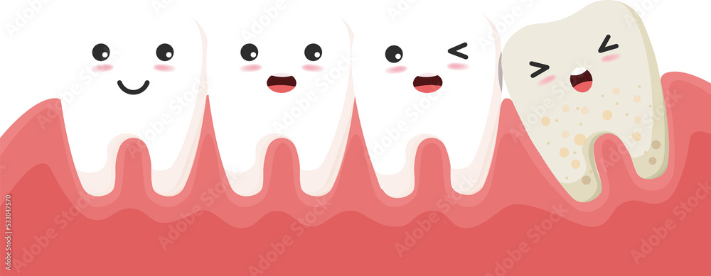 Wisdom tooth push other tooth. Impacted wisdom tooth character pushing ...