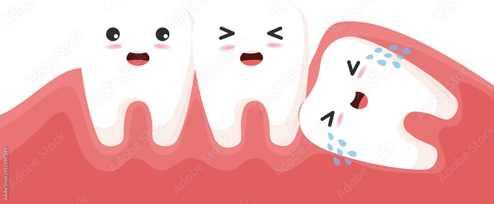 Wisdom tooth push other tooth. Impacted wisdom tooth character pushing ...