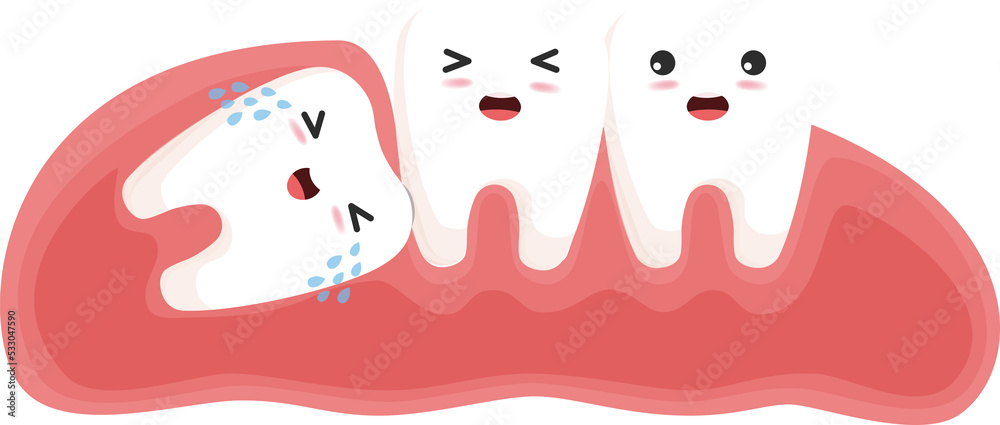 Wisdom tooth push other tooth. Impacted wisdom tooth character pushing ...