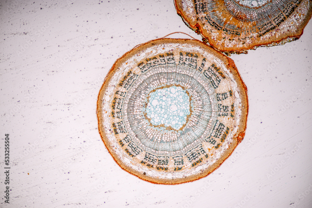 Plant tissue Structure, section (tissue) of stem plant tissue under a ...