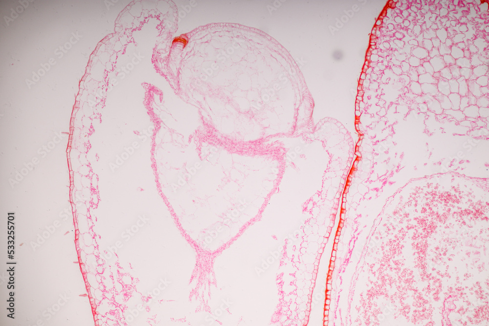 Plant tissue Structure, section (tissue) of stem plant tissue under a ...