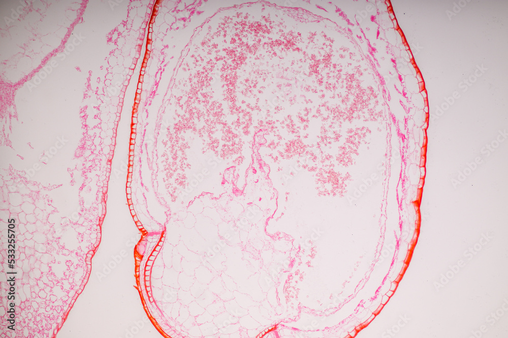 Plant tissue Structure, section (tissue) of stem plant tissue under a ...