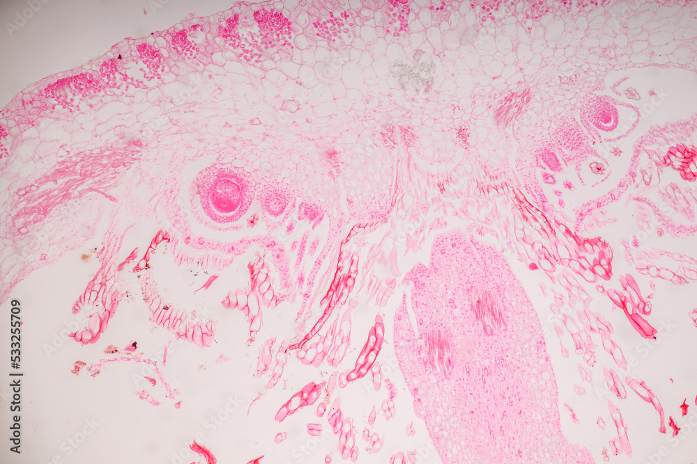 Plant tissue Structure, section (tissue) of stem plant tissue under a ...