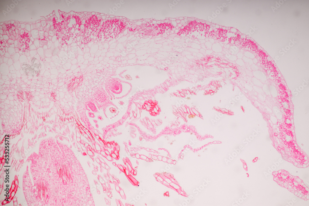 Plant tissue Structure, section (tissue) of stem plant tissue under a ...