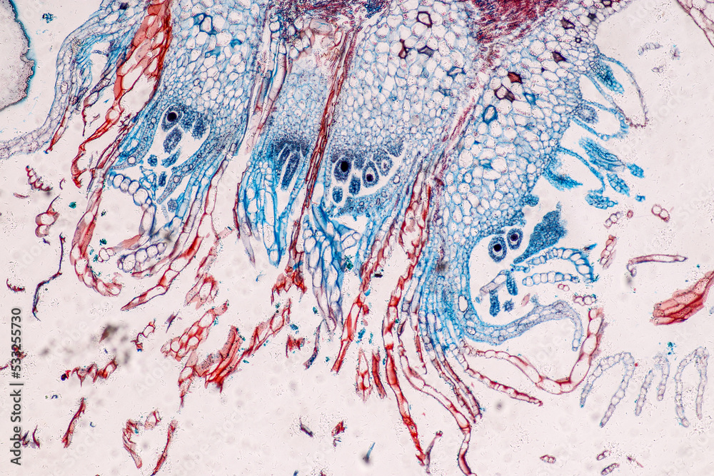 Plant tissue Structure, section (tissue) of stem plant tissue under a ...