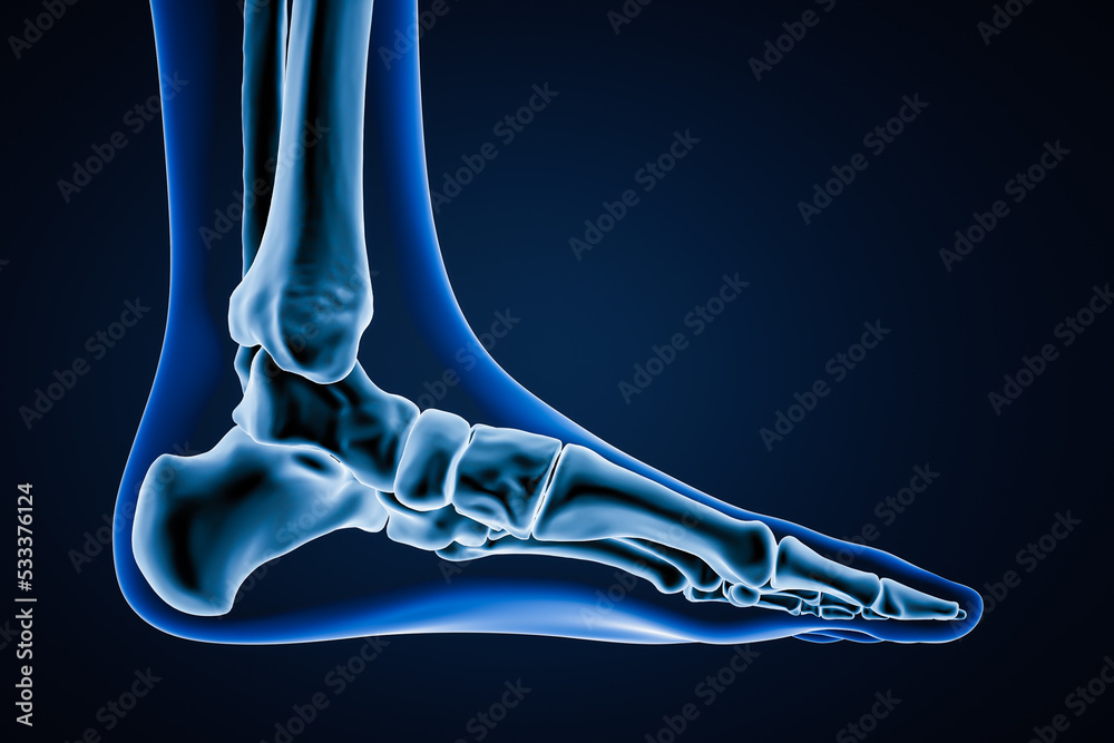 Medial view of accurate human left foot bones with body contours on ...