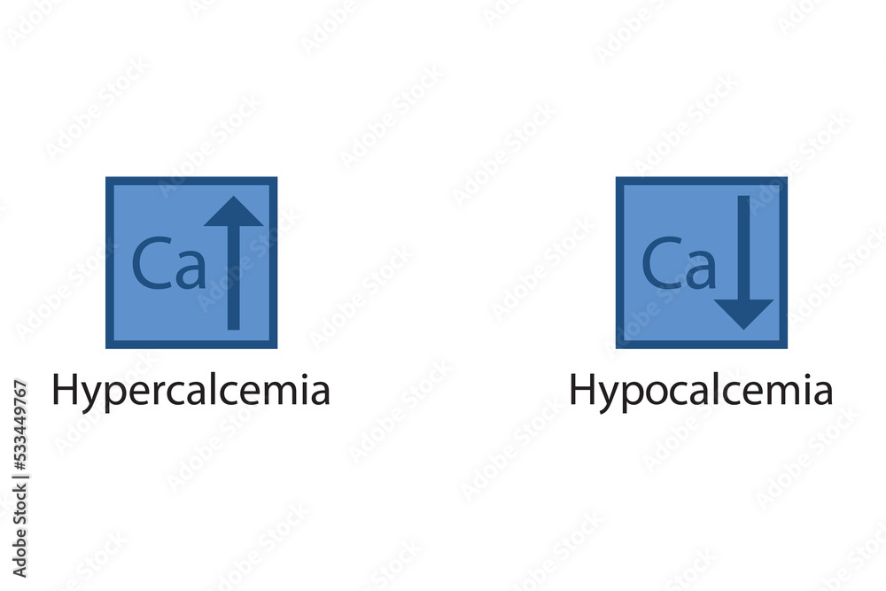 Hypercalcemia and Hypercalcemia – Calcium Ca excess and deficit ...