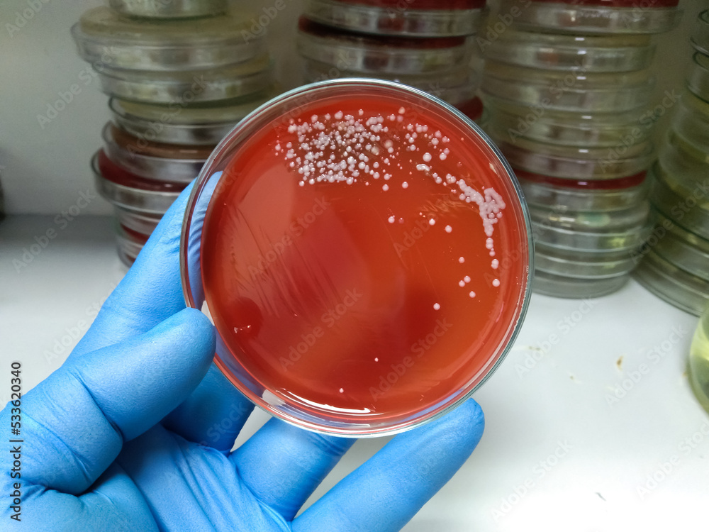 Staphylococcus aureus: Gram-positive, to Gram-variable, nonmotile ...
