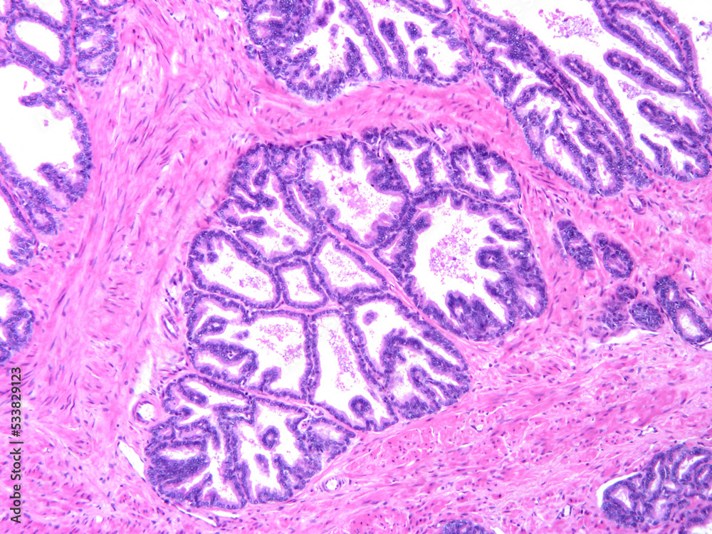 Foto de Histology of human tissue, show epithelial tissue and ...