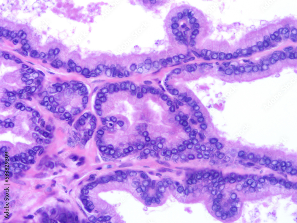 Histology of human tissue, show epithelial tissue and connective tissue ...