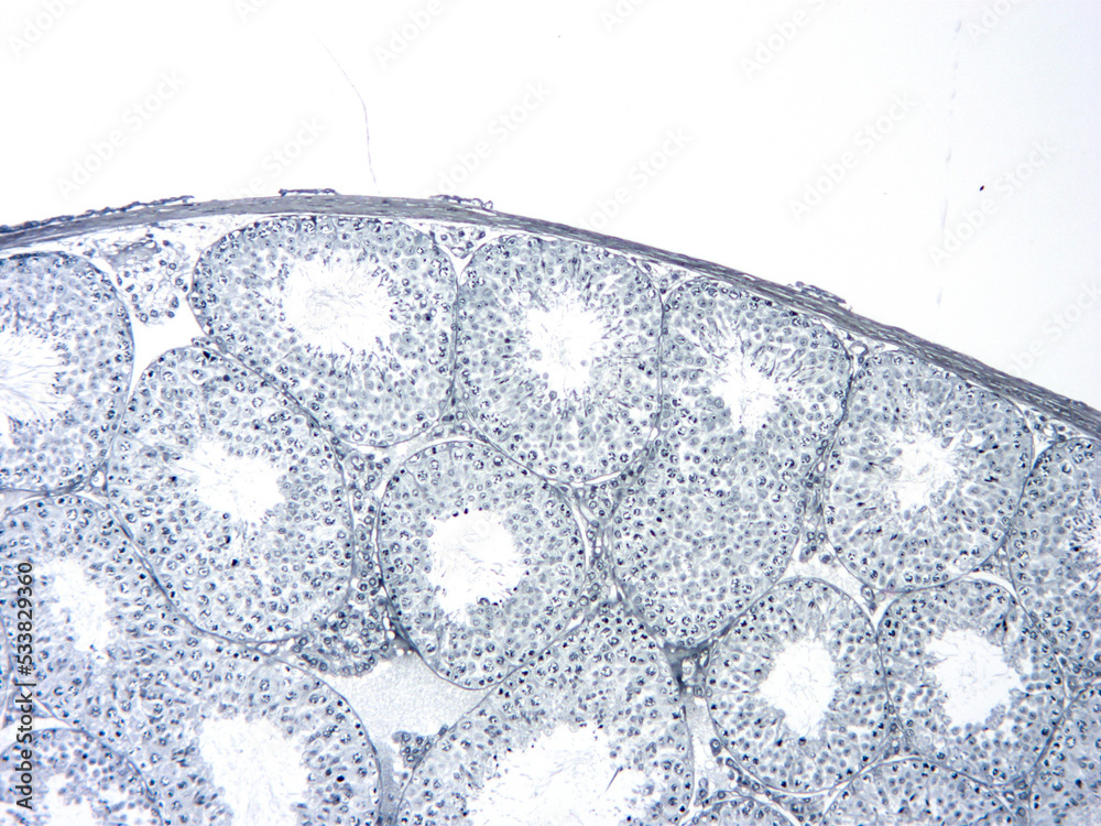 Histology of human tissue, show epithelial tissue and connective tissue ...