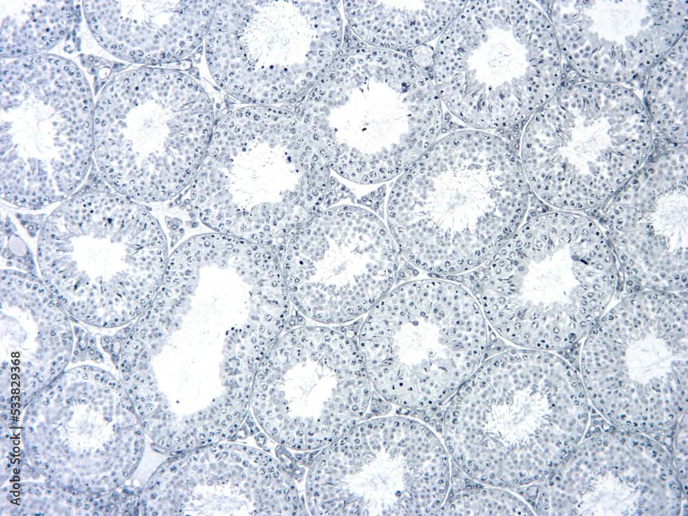 Histology of human tissue, show epithelial tissue and connective tissue ...