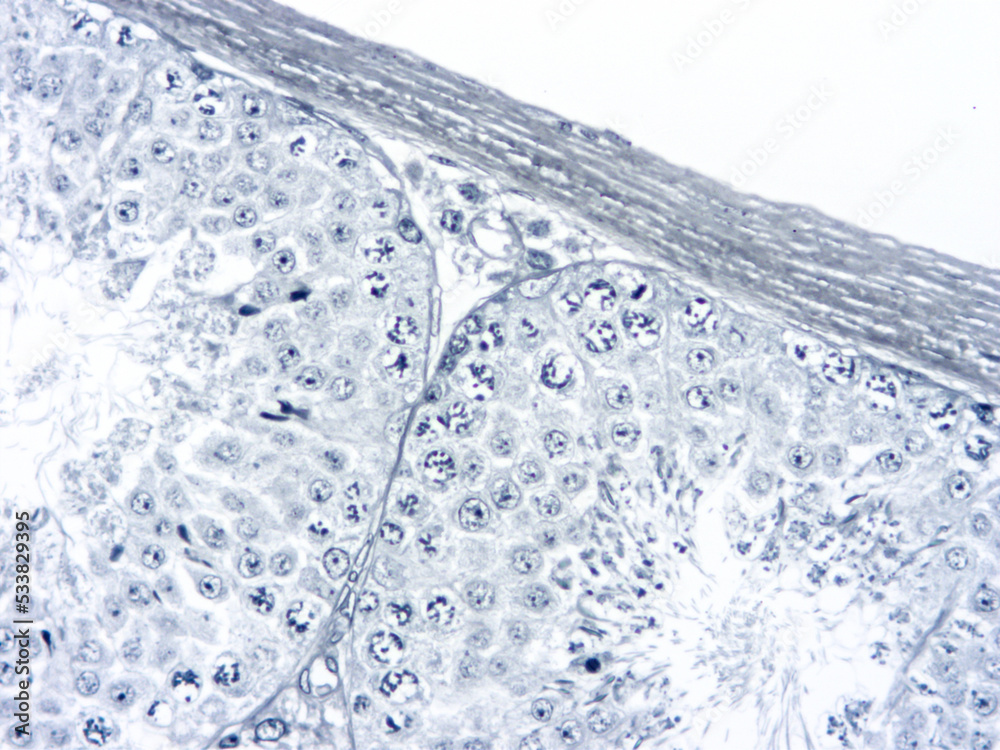 Histology of human tissue, show epithelial tissue and connective tissue ...