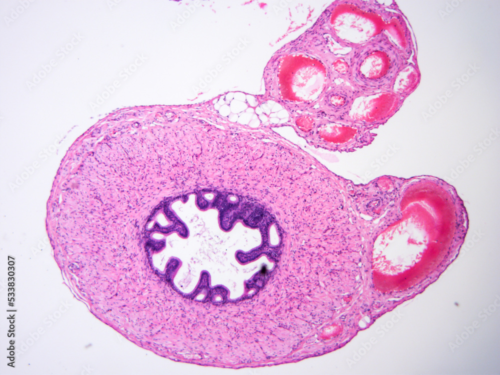 Histology of human tissue, show epithelial tissue and connective tissue ...