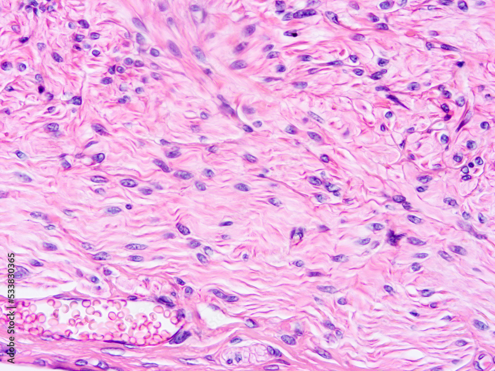 Histology of human tissue, show epithelial tissue and connective tissue ...