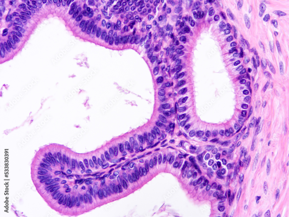 Histology of human tissue, show epithelial tissue and connective tissue ...