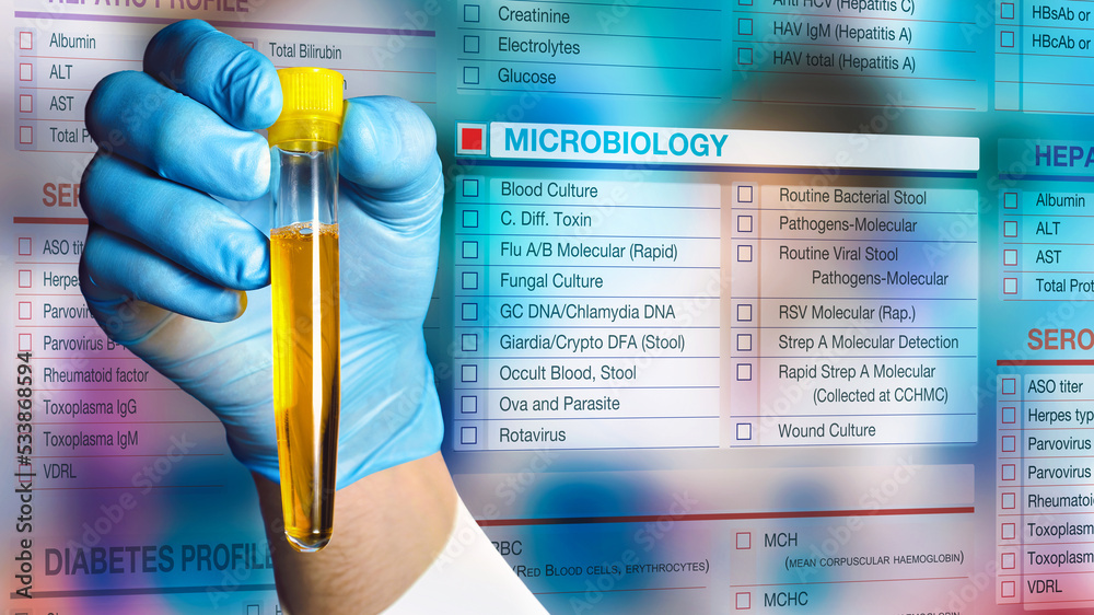 Microbiologist holding urine sample tube and background microbiology ...