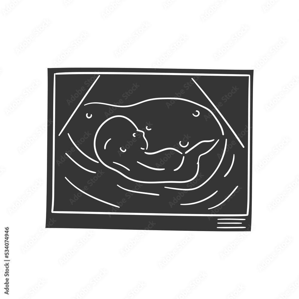 Baby Ultrasound Icon Silhouette Illustration. Sonar Vector Graphic ...