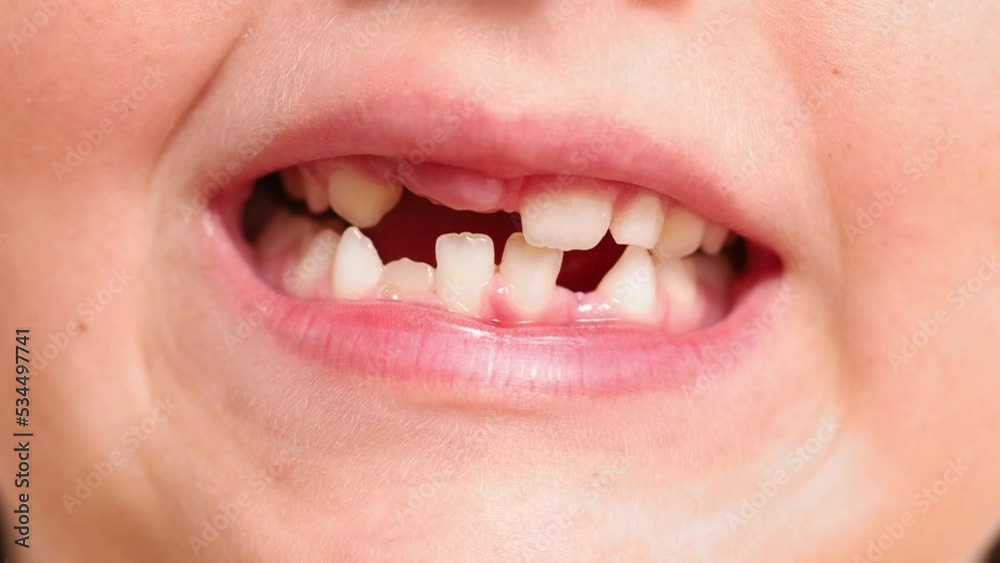 Close up video shot of unrecognizable child toothless mouth with milk ...