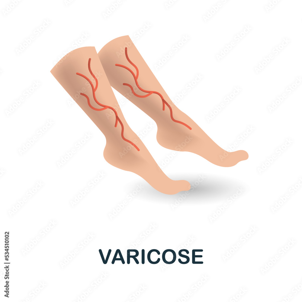Varicose icon. 3d illustration from deseases collection. Creative ...